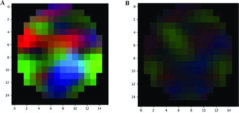 Example Of Eeg Topographic Map A High Arousal State B Low Arousal