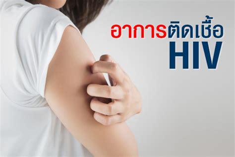 อาการติดเชื้อhiv จะทราบได้อย่างไรว่า เราได้รับเชื้อเอชไอวี Hivอาการ ที่