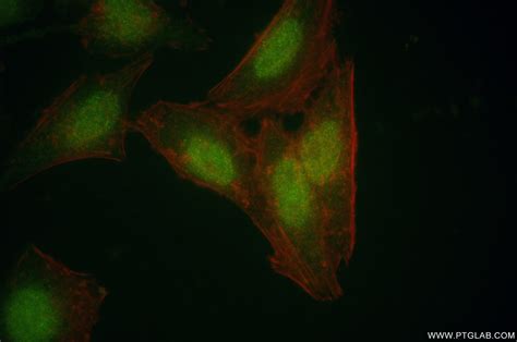 Cdk6 Antibody 84200 1 Rr Proteintech