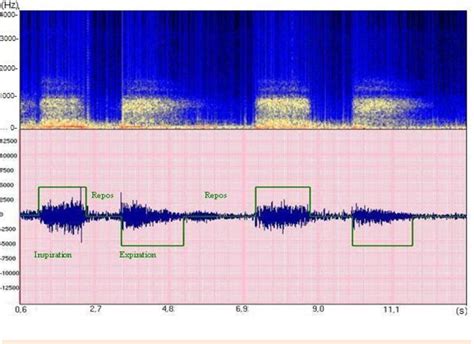 Figure 3 From Respiratory Sound Analysis In The Era Of Evidence Based