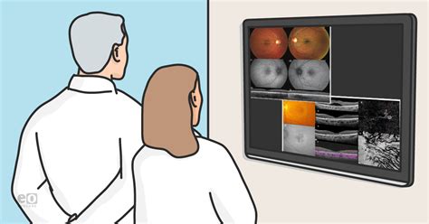 An Optometrists Guide To Pachychoroid Spectrum Conditions