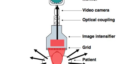 Take 4 Components Of Fluoroscopy