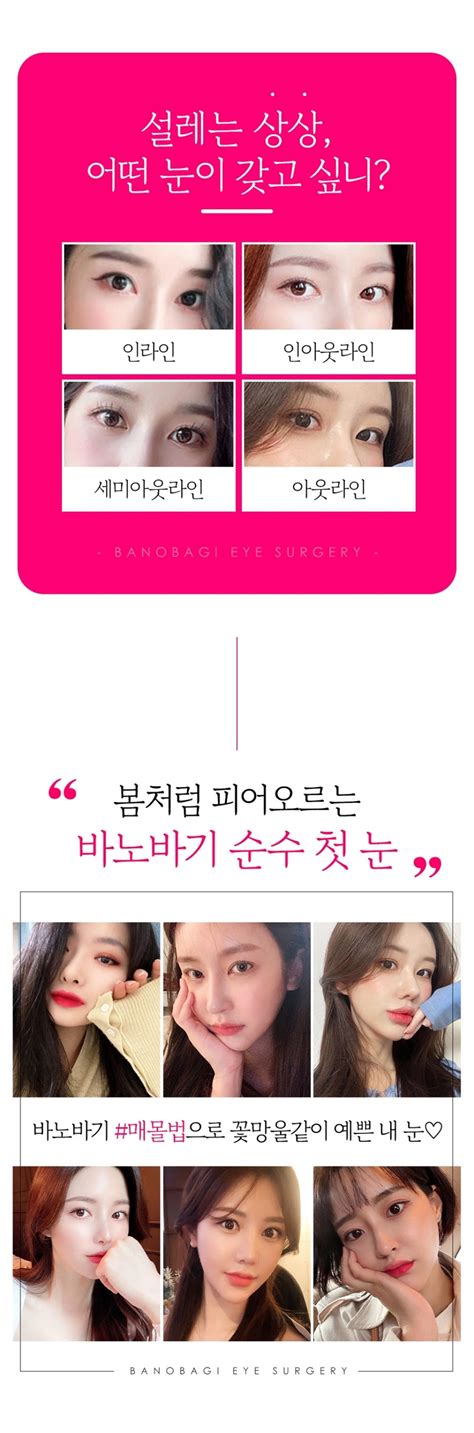 쌍커풀 눈매교정 재수술 및 쌍꺼풀 수술 가격 및 전후 차이 비교 네이버 블로그