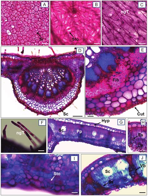 A J Leaf Anatomy Of Xylopia Aromatica In Transverse And Paradermal Download Scientific Diagram