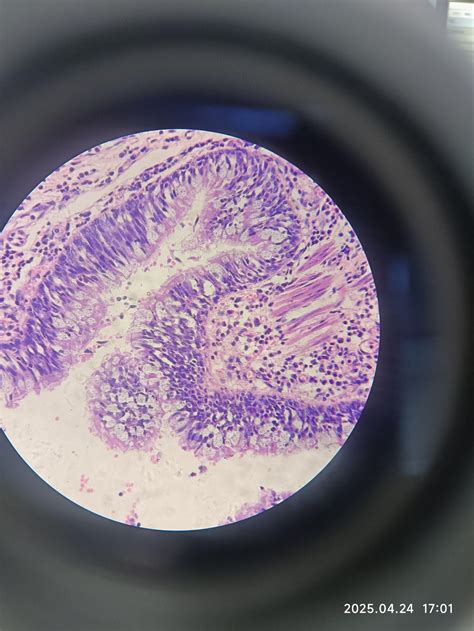 病理学实验切片——慢性支气管炎 知乎