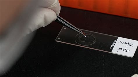 Rna Fluorescence In Situ Hybridization For Long Non Coding Rna Localization In Human