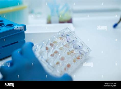 In Vitro Cellular Assay Using Multi Pipette And Well Plate Cell Culture