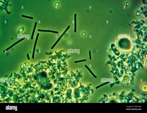Lactobacillus Bulgaricus Slide Evolutionary Engineering Of