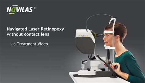[video] Od Os Inc On Linkedin Far Periphery Without Contact Lens Navigated Laser Retinopexy