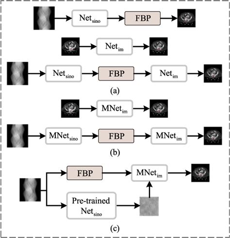 Figure 1 From Coupling Model And Data Driven Networks For Ct Metal Artifact Reduction
