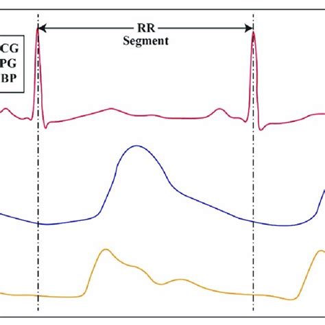 Ppg Ecg And Abp Signals In Mimic Iii Datasets Download Scientific Diagram