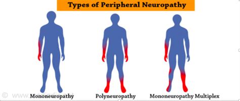 Peripheral Nerve Pathology Flashcards Quizlet