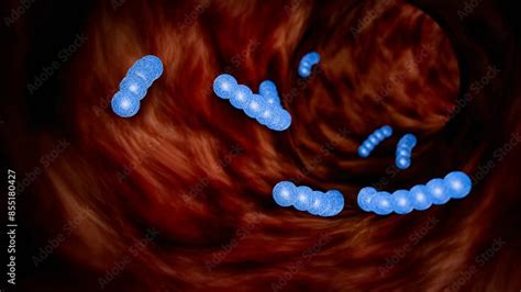 Streptococcus Type A Flesh Eating Bacteria The Spread Of Bacteria In The Body Rare But Severe