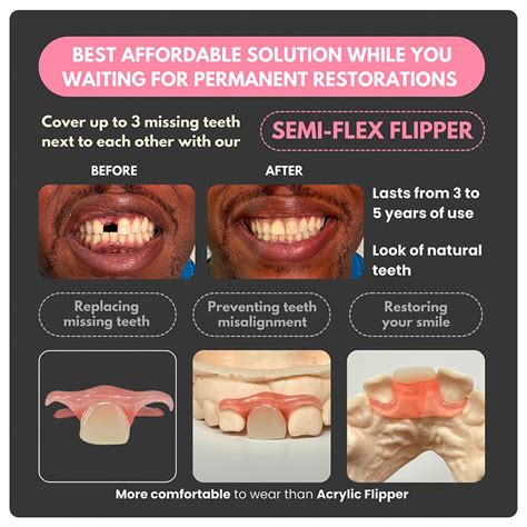 Semi Flex Flipper For Up To 3 Teeth Dental Solution