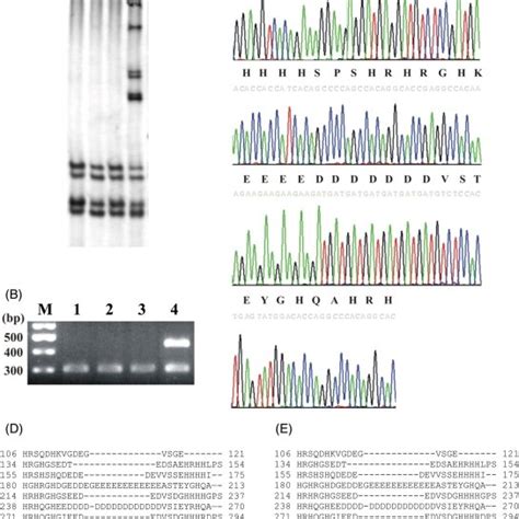 Representative Example Of Single Strand Conformational Polymorphism