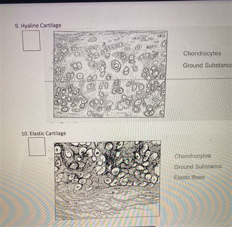 Solved 1 Simple Squamous Epithelium Nucleus Gytoplasm Cell