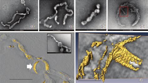 Pleomorphic Variations In Ph1n1 2009 Influenza Virus A C Extreme Download Scientific