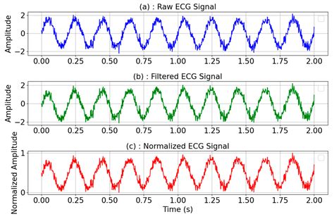 Intelligent Stress Detection Using Ecg Signals Power Spectrum Imaging With Continuous Wavelet