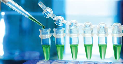 Facilitating Adoption Of A New Biomarker Test For Prostate Cancer Ismar Healthcare NV