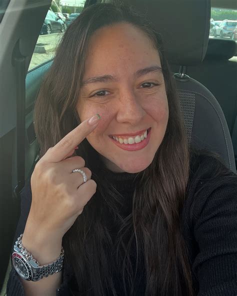 مش معقولة يوم واحد اقعد في الشمس النمش يظهر و ينور كده يا جماعة 🙈🙄😂 قبل