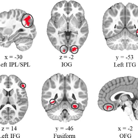 Rois Used In Hippocampal Functional Connectivity Analyses Adapted From