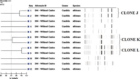 dendrogram analysis and virtual gel image of rep pcr fingerprint
