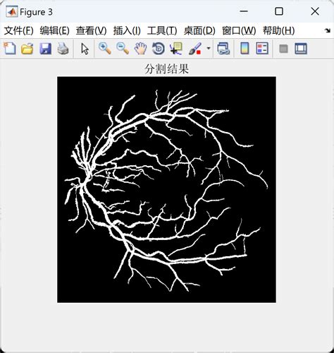 【图像分割】血管分割（matlab实现） matlab分割眼底出血点 csdn博客