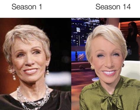 Barbara Corcoran Reveals Shes Gotten 2 Facelifts