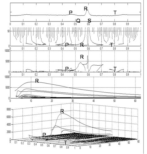Four Views Of Modulus Maxima Lines Of A 10 Second Signal Of Normal Download Scientific Diagram