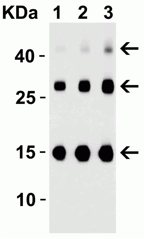 Tslp Antibody Cat No 4023 Prosci