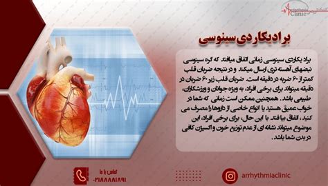 ریتم سینوسی قلب و آریتمی سینوسی علل، علائم و نحوه تشخیص