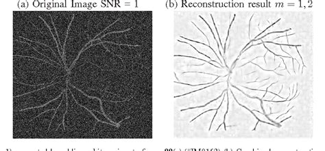 Figure 12 From Analysis Of Retinal Vasculature Using A Multiresolution Hermite Gaussian Model