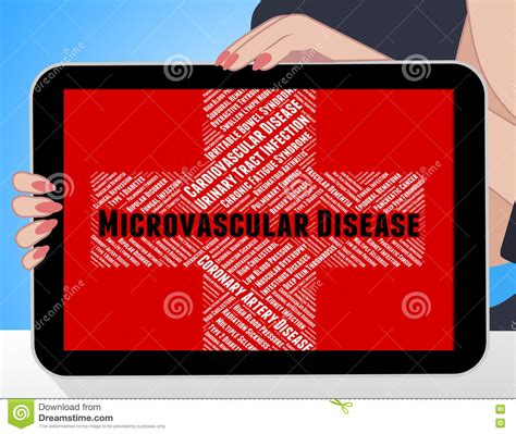 Microvascular Disease Shows Poor Health And Afflictions Stock Illustration Illustration Of