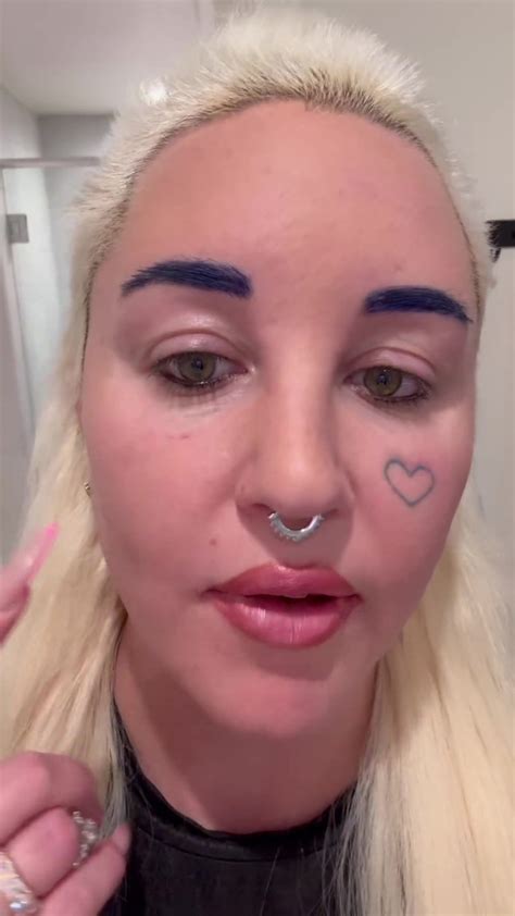 Amanda Bynes Opens Up On Having Self Esteem Boosting Eyelid Surgery