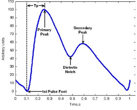 Example Of Ppg Signal Pulses Definition Download Scientific Diagram