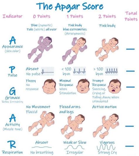 Low Apgar Score Affiliatelery