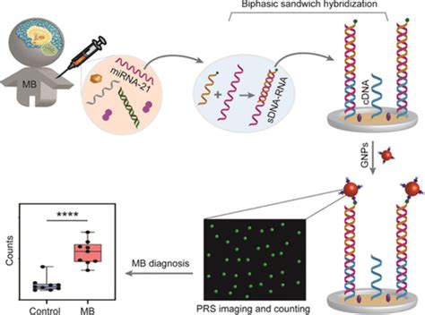 Single Molecule Detection Of Serum Micrornas For Medulloblastoma With Biphasic Sandwich