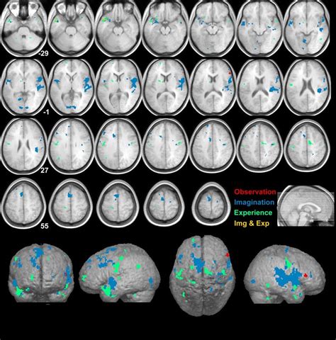 Ppi Maps Of The Whole Brain Functional Connectivity Of The Whole Brain Download Scientific