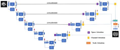 Innovative Noise Extraction And Denoising In Low Dose Ct Using A Supervised Deep Learning Framework