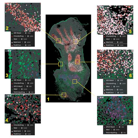 Webatlas Pipeline For Integrated Single Cell And Spatial Transcriptomic Data Human