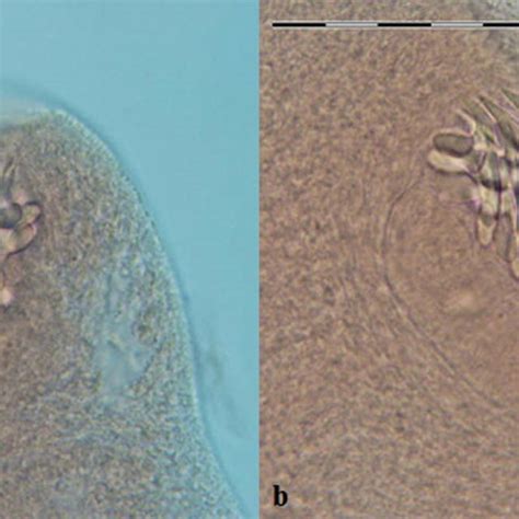Photomicrographs Of The Scolex Of Echinococcus Multilocularis A And