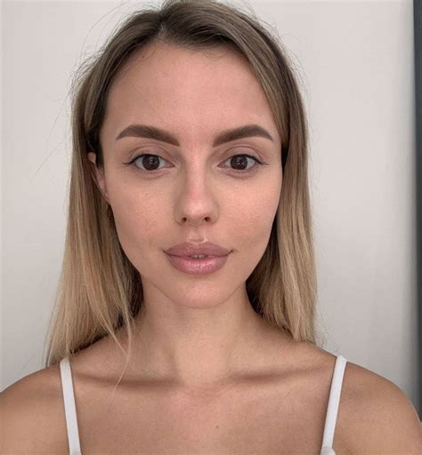 Платизма — це поверхневий мяз шиї який напряму впливає на овал обличчя друге підборіддя та