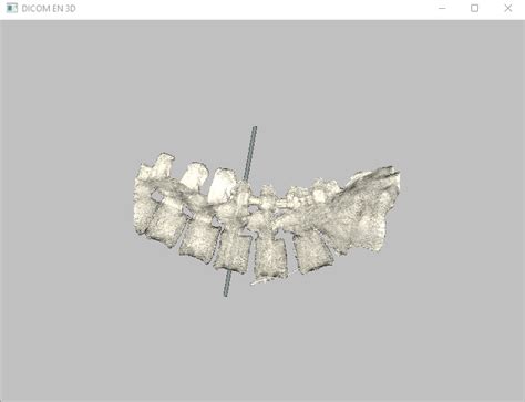 GitHub JCM DicomPython Extracting Metadata From DICOM Files And