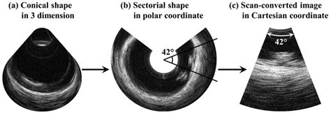 Scan Conversion Algorithm A Acquired Image In 3 Dimensions By The Download Scientific