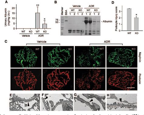 Figure 5 From Wnt Beta Catenin Signaling Promotes Podocyte Dysfunction