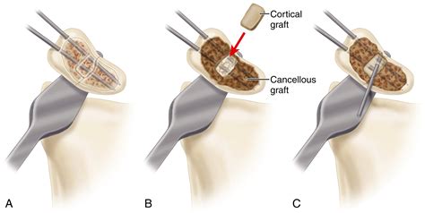 Wrist Disorders Clinical Tree