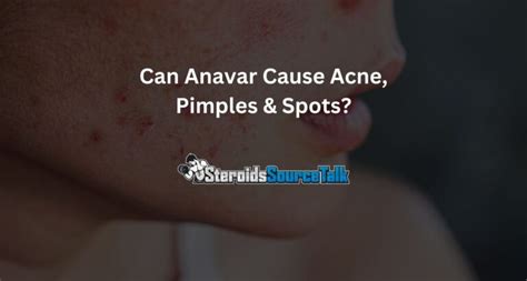 Anavar And Test Cycle Benefits Dosage Side Effects And Optimal Stacking Guide