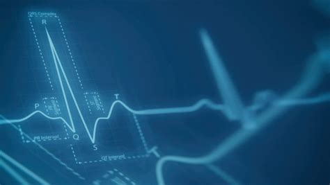 Advancements In Atrial Fibrillation Detection Embracing It Innovations