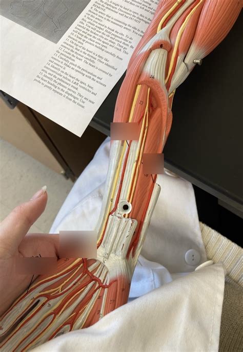 Arm Diagram Quizlet