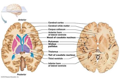 Overview Of Sympathetic Pathways Preganglionic Axons Of The Sympathetic Division Extend From
